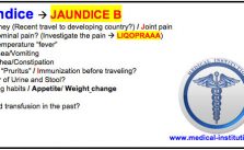 Jaundice Mnemonic - Best USMLE Step 2 CS Mnemonics