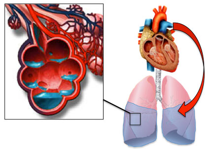 Congestive Heart Failure (CHF) - A Comprehensive Overview