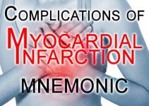 Jaundice Mnemonic - Best USMLE Step 2 CS Mnemonics